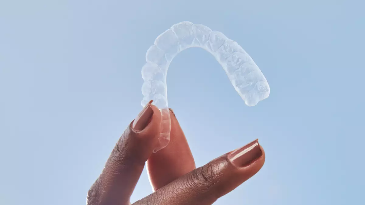 Cupom SouSmile: aparelho invisível SouSmile funciona? Minha experiência ...